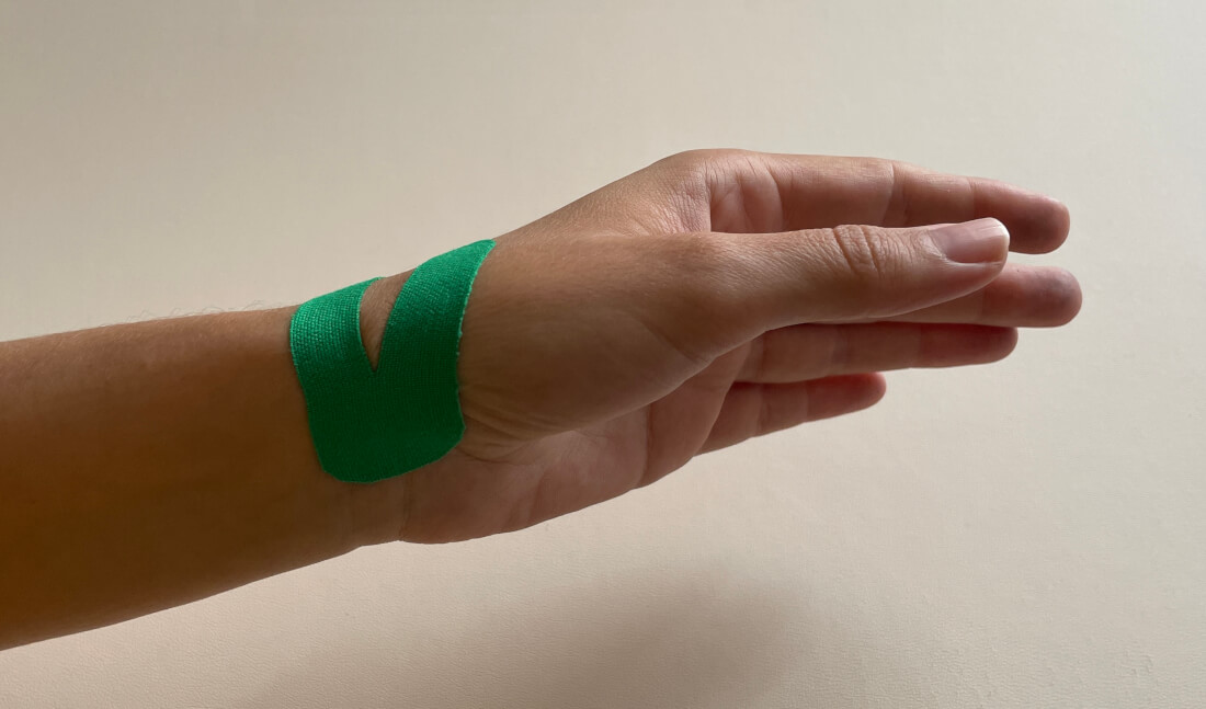 Einfaches Tape bei Sehnenscheidenentzündung